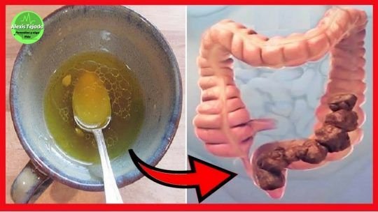 Remedio para limpiar el Colon – Ignis Natura